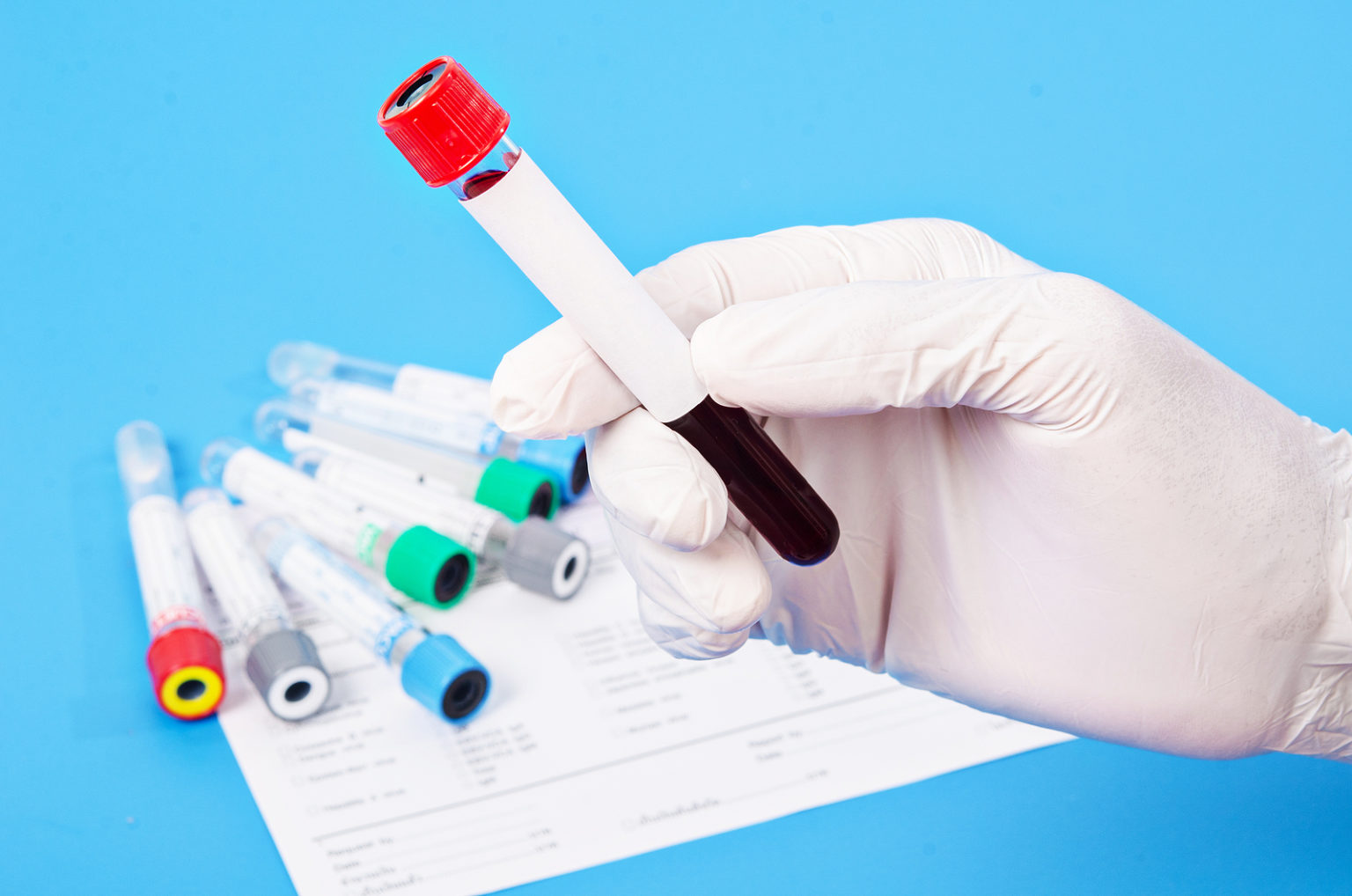 Maryland Phlebotomy Schools & Certification Information ...